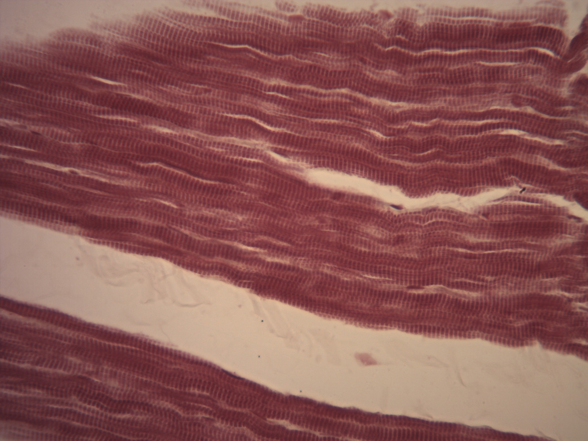 Historep » Tecido muscular